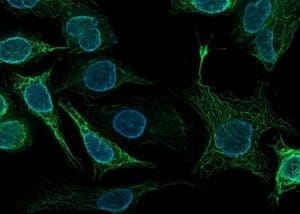 The First Microscope to Modern Microscopes: Evolution and History of ...