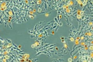 Phase Contrast Microscopy: A Simple Explanation – Microscope Clarity