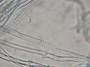 What is Mycelium? – Microscope Clarity