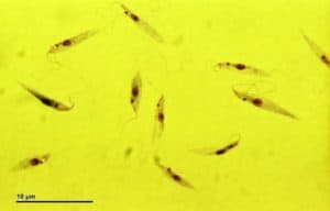 Protozoa: Explained – Microscope Clarity