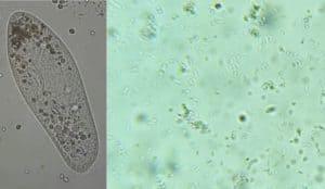 Protozoa: Explained – Microscope Clarity