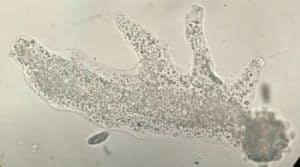 What is an Amoeba? – Microscope Clarity