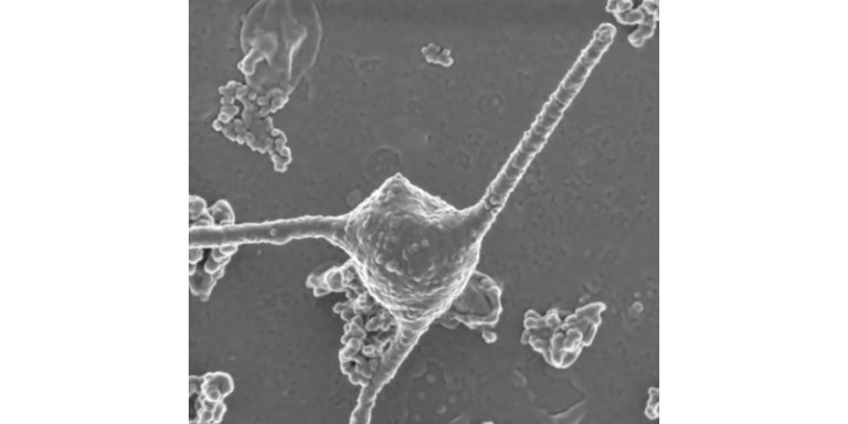 Archaea: Ancient Microorganisms – Microscope Clarity