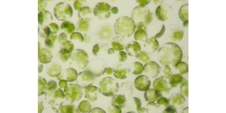 Plastids: Everything You Need to Know and More – Microscope Clarity