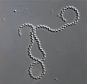 What Are Spirilla Bacteria? – Microscope Clarity