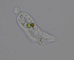 What is an Amoeba? – Microscope Clarity
