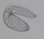 What is Blepharisma? – Microscope Clarity