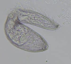 What is Blepharisma? – Microscope Clarity