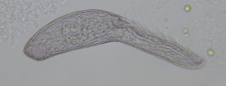 What is Blepharisma? – Microscope Clarity