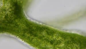 What is Hydra? (Microorganism) – Microscope Clarity