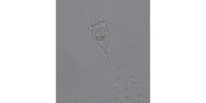 What are Vorticella? – Microscope Clarity