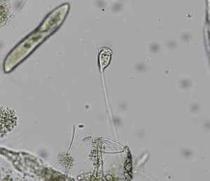 What are Vorticella? – Microscope Clarity