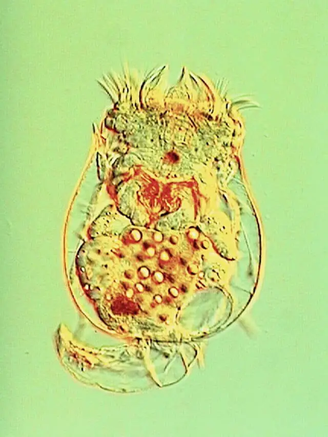 Rotifers: Structure, Characteristics, and Classification – Microscope ...