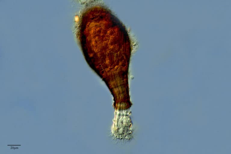 Rotifers: Structure, Characteristics, and Classification – Microscope ...