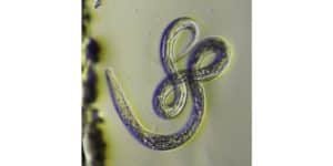 Nematodes: Classification, Structure, and Characteristics – Microscope ...