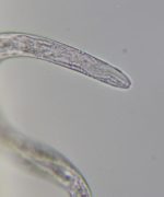 Nematodes: Classification, Structure, and Characteristics – Microscope ...