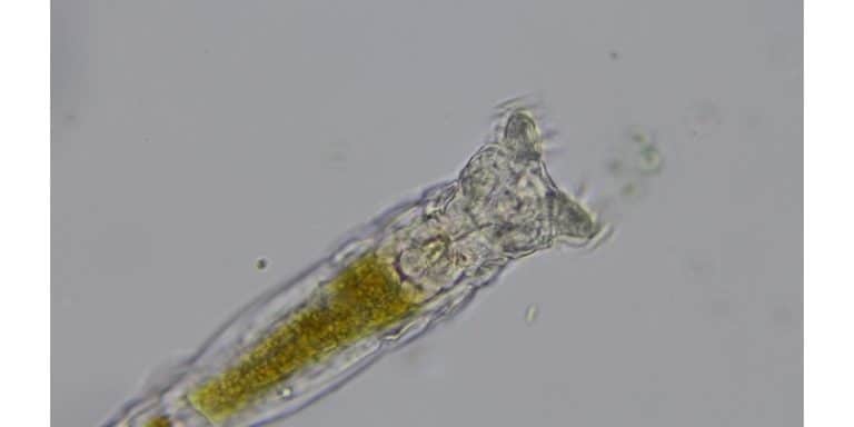 Rotifers: Structure, Characteristics, and Classification – Microscope ...