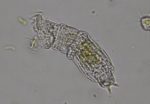 Rotifers: Structure, Characteristics, and Classification – Microscope ...