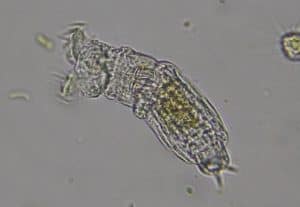 Rotifers: Structure, Characteristics, and Classification – Microscope ...