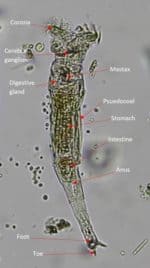 Rotifers: Structure, Characteristics, and Classification – Microscope ...