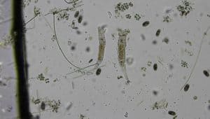 Rotifers: Structure, Characteristics, and Classification – Microscope ...