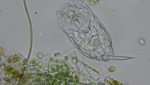 Rotifers: Structure, Characteristics, and Classification – Microscope ...