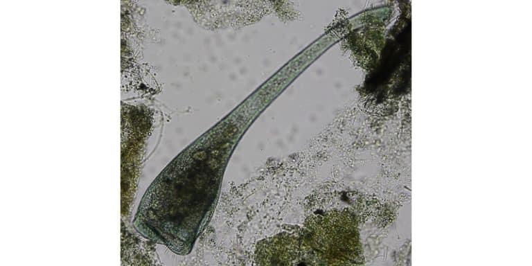 Stentor: Structure, Classification, and Characteristics – Microscope Clarity