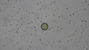 What are Volvox? – Microscope Clarity