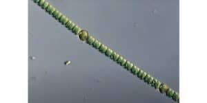 Anabaena: Classification and Characteristics – Microscope Clarity