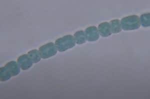 Anabaena: Classification and Characteristics – Microscope Clarity