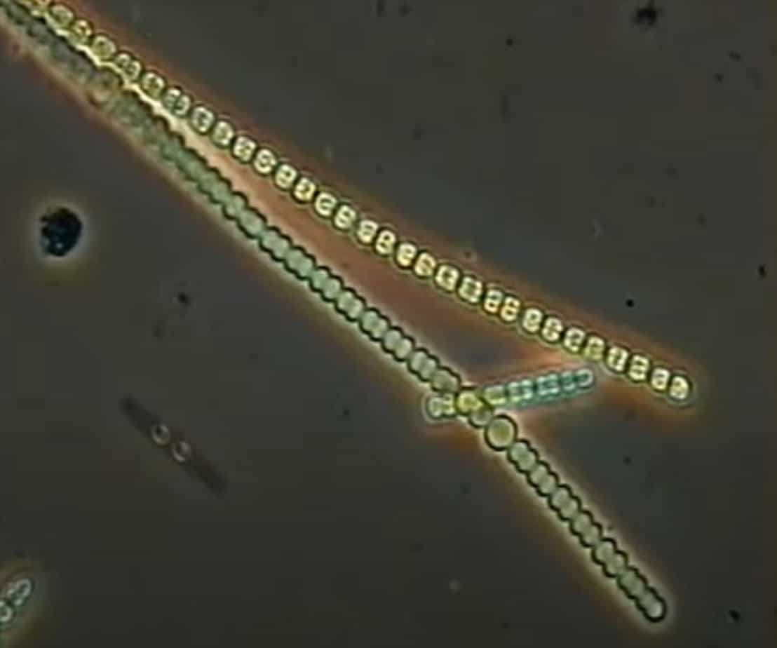 Anabaena: Classification and Characteristics – Microscope Clarity