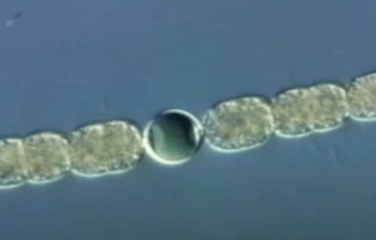 Anabaena: Classification and Characteristics – Microscope Clarity