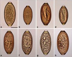 What are Helminths? – Microscope Clarity