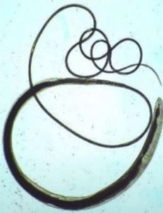 What are Helminths? – Microscope Clarity