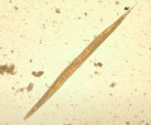 What are Helminths? – Microscope Clarity